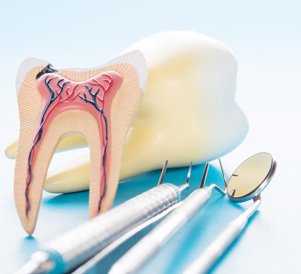 Root Canal Treatment Tunbridge Wells | Endodontist Tunbridge Wells